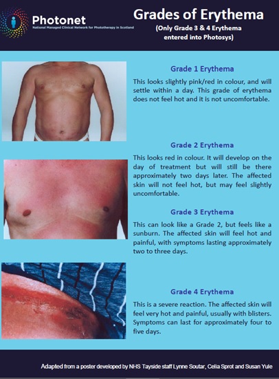 Photonet Guidance – Photonet